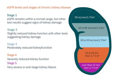 CKD diagnosis | infoKID